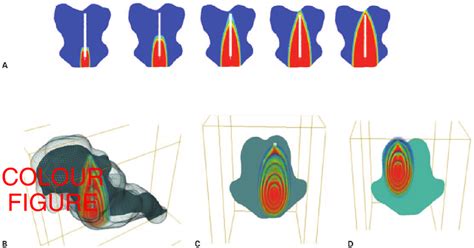 Results Of The Three Computational Simulations Closely Resembled Those