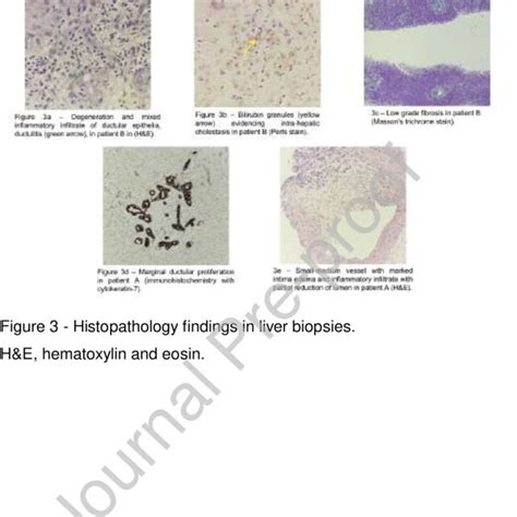 Magnetic Resonance Imaging With Cholangiopancreatography And Download Scientific Diagram