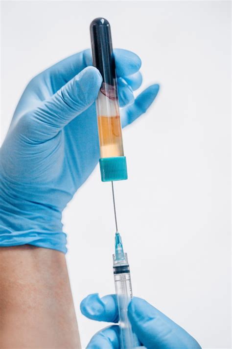 Study Shows Benefits Of Prp Therapy For Hamstring Injuries Health Socially Best Health Resources Study Shows Benefits Of Prp Therapy For Hamstring Injuries Health Socially Best Health Resources