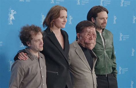 “my Disability Has Opened Doors” Actor Adam Pearson Wants To Normalize Facial Disfigurement