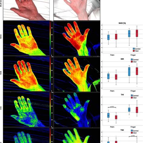 Red Green Blue Image And Images Derived From Hsi Of The Palm Boxplots Download Scientific