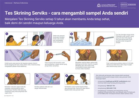 Program Nasional Skrining Serviks Bagaimana Caranya Mengambil Sampel