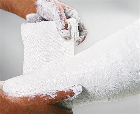 Landr Global Cellona Plaster Of Paris Bandage