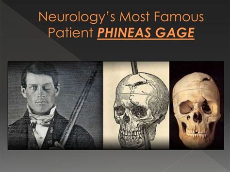 Pyramidal Tract And Extra Pyramidal Tracts Pptx
