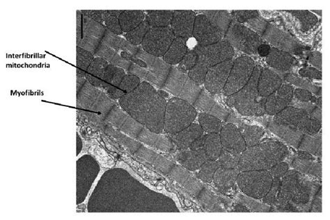 Electron Microscopy Image Of The Mouse Heart Download Scientific Diagram