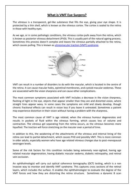 Vitreomacular Traction Treatment Causes And Symptoms Pdf