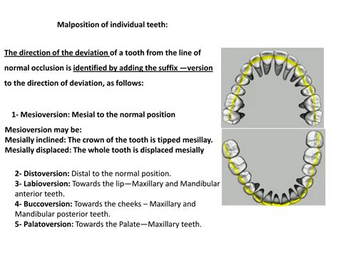 Classification Of Occlusion And Malocclusion Dr Nabil Al Zubair Pdf