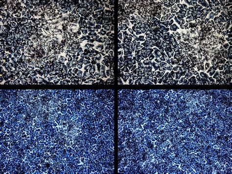 How Does One Interpret These Results Of Virus Plaque Assay Researchgate