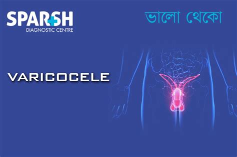 Varicocele Sparsh Diagnostic Center