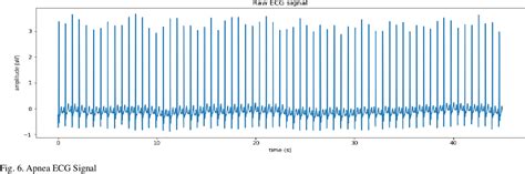 Figure 6 From Effectiveness Of Wavelet And Fourier Transform Methods For Denoising Ecg Apnea