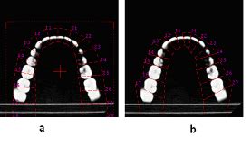 Numbered Grid Of Segmentation A Before The Calibration B After Download Scientific Diagram