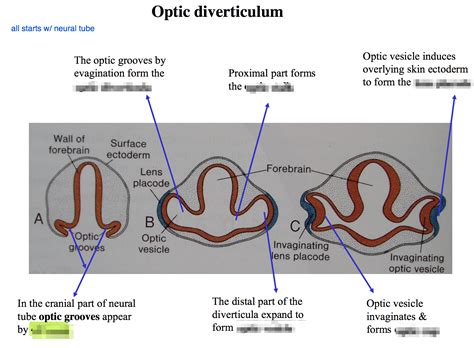 Lens Placode Embryology Pathology Ento Key A Thickened Portion Of Ectoderm Which Serves As