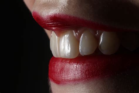 Aesthetic Dentistry — Dr Ramirez Aesthetic Dentistry