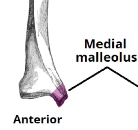 Tibial Pilon Fracture TeachMeSurgery
