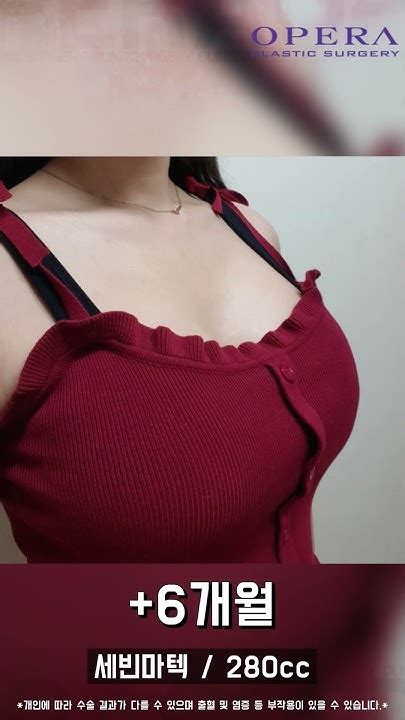 [오페라성형외과] 남들이 부러워하는 몸매 Youtube