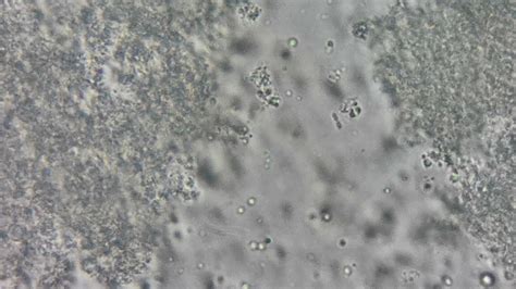 Yogurt Under Microscope At William Fellows Blog