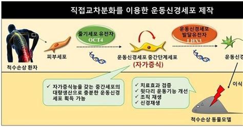unist 척수 마비 환자 세포치료 길 열어