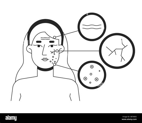 Blonde Woman Skin Problems Face Diagram Line Illustration Concept Stock Vector Image And Art Alamy