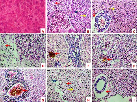 Sections Of The Liver Of Fish Showing Control A X400 Focal Areas