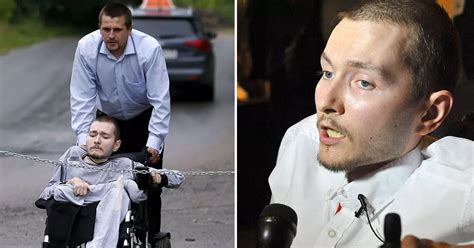 Groundbreaking Head Transplant Patient Says He And Controversial Doctor