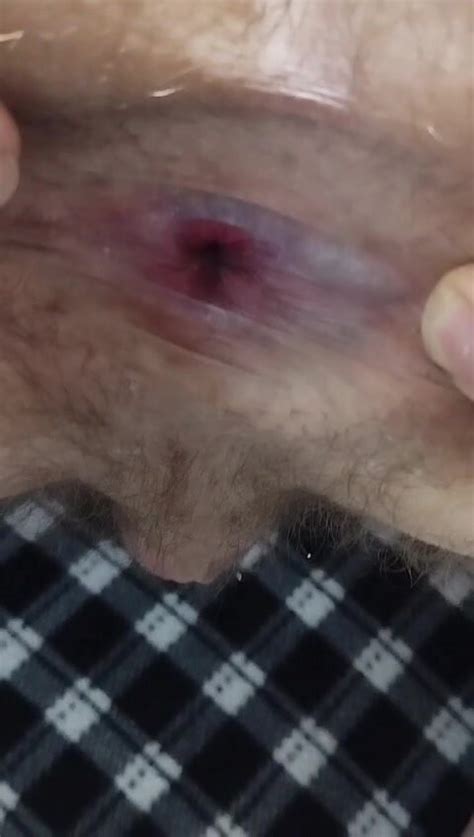 Hairy Pink Asshole Spreading Thisvid Com