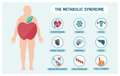 Common Symptoms Of Metabolic Syndrome Artofit