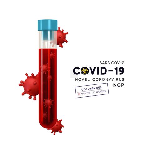 Premium Vector Laboratory Blood Test For Virus Covid Novel Coronavirus Ncov Denoted