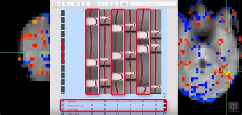 Harvard FSL Workshop 2021 Andy S Brain Blog