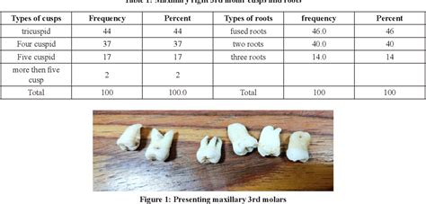 Teeth Plunger Cusp At Ava Soul Blog