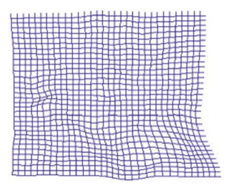 Registration Results Of Testing A Pair Of Medical Lung Images Using Our Download Scientific