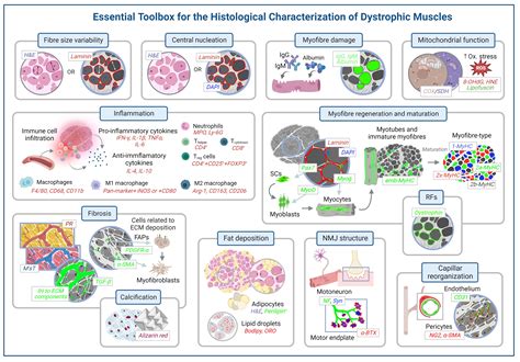 Duchenne Muscular Dystrophy Histology