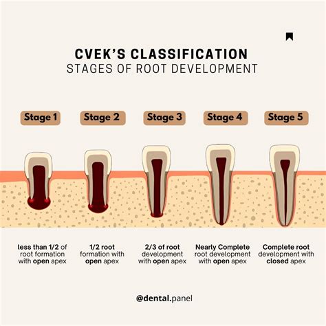 📚quick Read Cveks Classification Of Root Development