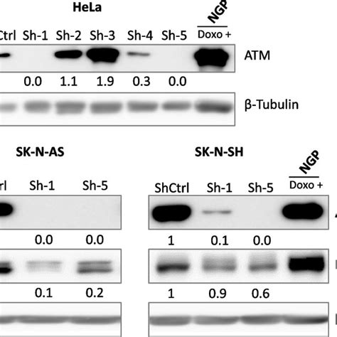Atm Knockdown Suppresses Fancd2 Expression In Nb Cells A Western Blot Download Scientific