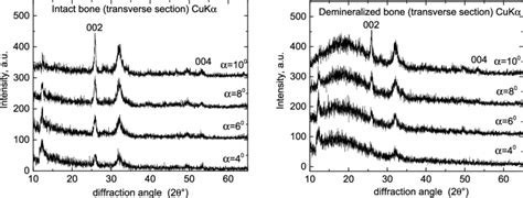 X Ray Diffraction Patterns Of The Intact Right And Partially