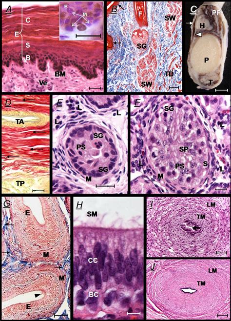 Pampiniform Plexus Histology