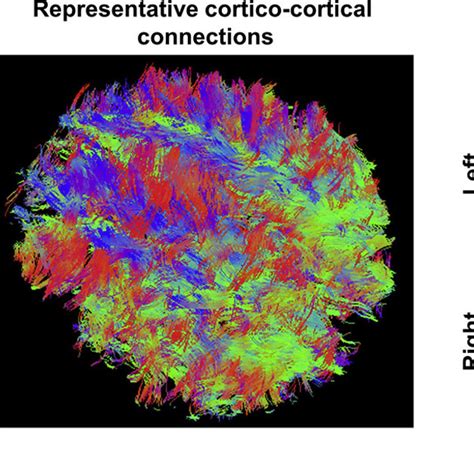 Structural Connectivity Analysis Abbreviation Fa Fractional