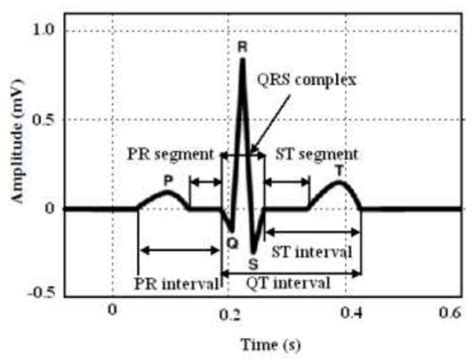 Schematic Representation Of Normal Ecg Waveform [3] Ecg