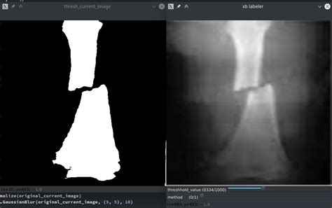 Python Image Threshold Algorithms To Use On An X Ray Image And Detect