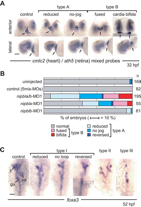 Effects Of Nipbl Mos On Heart And Gut Development A Heart Morphology Download Scientific