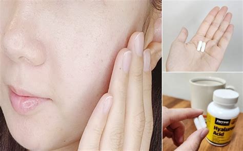 히알루론산 효능 피부 속 수분 충전이 필요할 때 먹는 히알루론산 Feat 자로우포뮬러스 순수 히알루론산 네이버 블로그