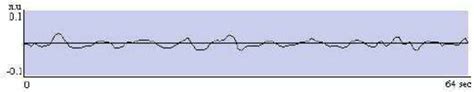 Local Minima And Maxima Detection And A1 A2 A3 A4 Computation