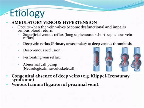 Venous Ulceers Pptx