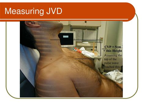 Ppt Cardiology History And Physical Powerpoint Presentation Free