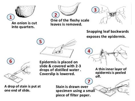 This Story Behind Microscope Scale Slide Will Haunt You Forever
