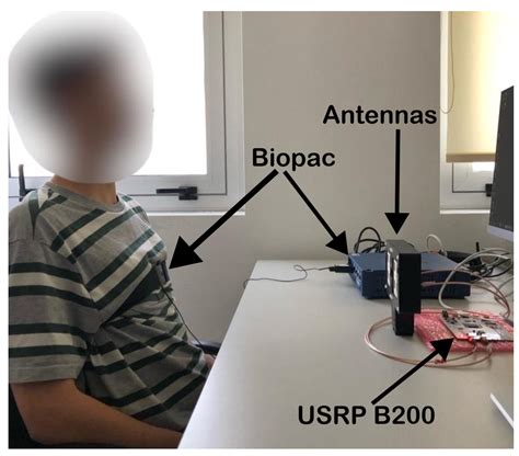 Detection Of Random Body Movements Using Clustering Based Methods In