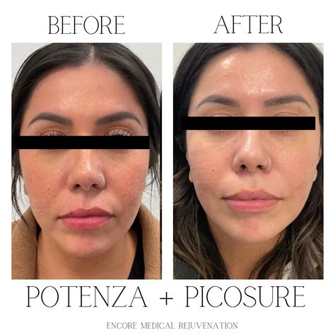 Encore Medical Rejuvenation Edmontons Luxury Medical Spa