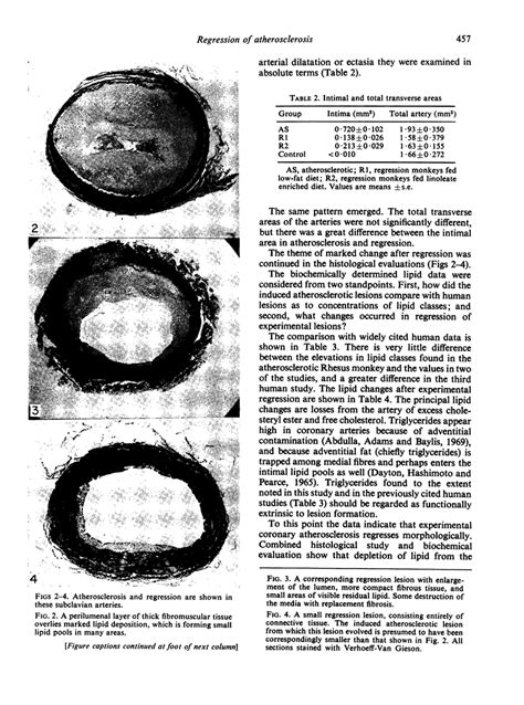 Evidence Of Regression Of Atherosclerosis In Primates And Man Pmc