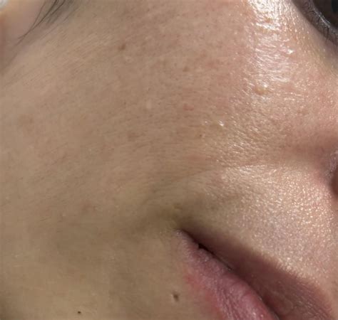 How Can I Make My Skin Look Smoother And Better Rskincareaddicts