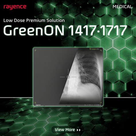 Rayence On Linkedin Greenon Rayence Xray Imagesolution Medicalsolution Diagnosis Gridon…