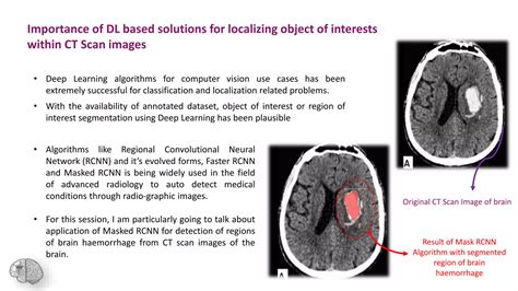 Application Of Masked Rcnn For Segmentation Of Brain Haemorrhage From